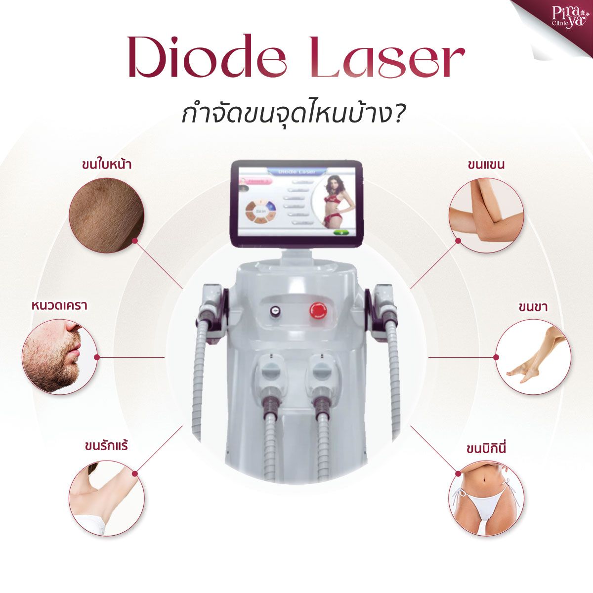 Diode Laser กำจัดขน ทำลายรากลึก | Piraya Clinic เมืองทอง